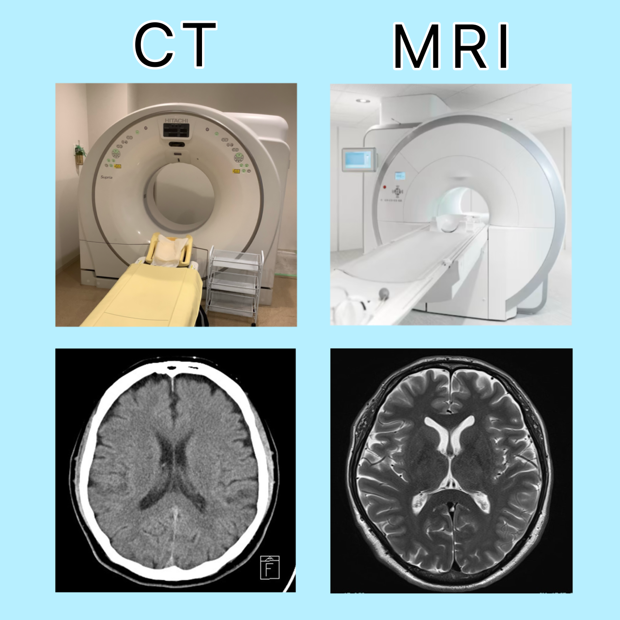 レントゲン・CT・MRIの違いとは？画像検査をわかりやすく解説！ | 専門家が教える【からだ】について